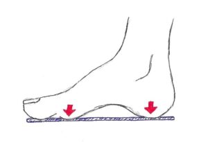 Why Are Insoles Important? | Vionic